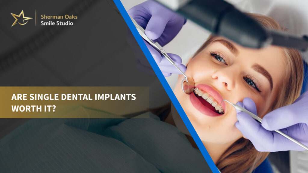 Upgrade Your Oral Health with a Single Dental Implant